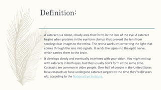 Cataract | PPTX
