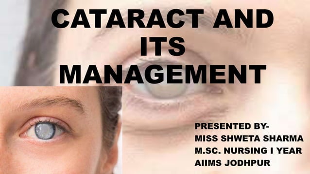 Cataract and its management | PPTX | Eye and Vision Conditions ...