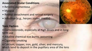 Cataract and its management | PPTX