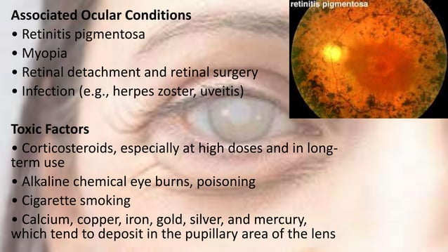 Cataract and its management | PPTX | Eye and Vision Conditions ...