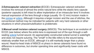 Cataract | PPTX