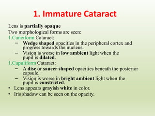 Cataract | PPT