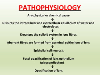 Cataract | PPT