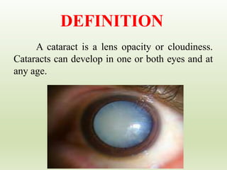 Cataract | PPT