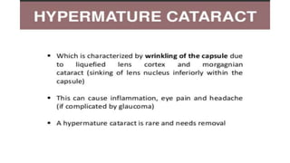 Cataract | PPT