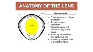 cataract | PPTX