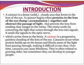 Cataract.pdf