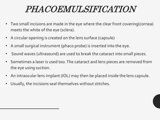 CATARACT.pptx