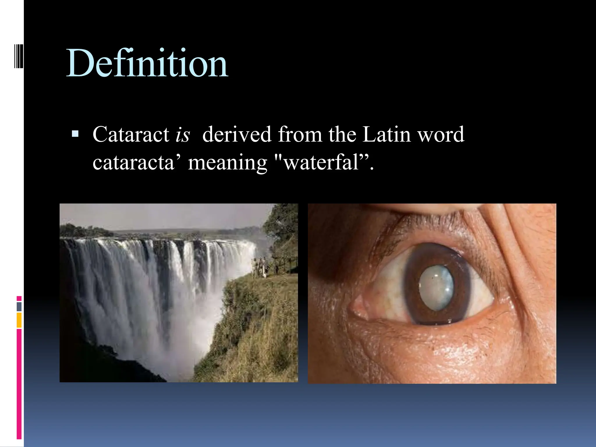 cataract.pptx