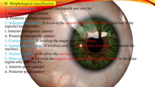cataract.pptx