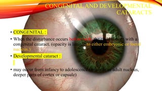 cataract.pptx