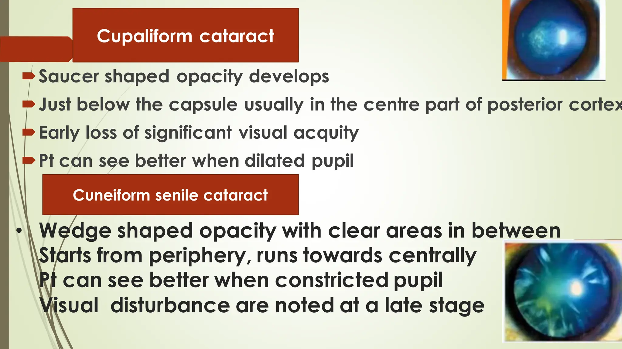 Etiological classification of cataract Dr.BKP
