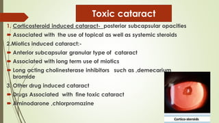 Etiological classification of cataract Dr.BKP