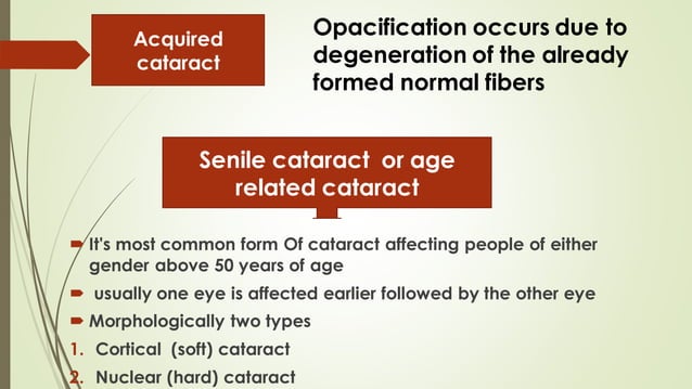 Etiological classification of cataract Dr.BKP | Eye and Vision ...