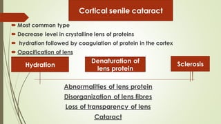 Etiological classification of cataract Dr.BKP