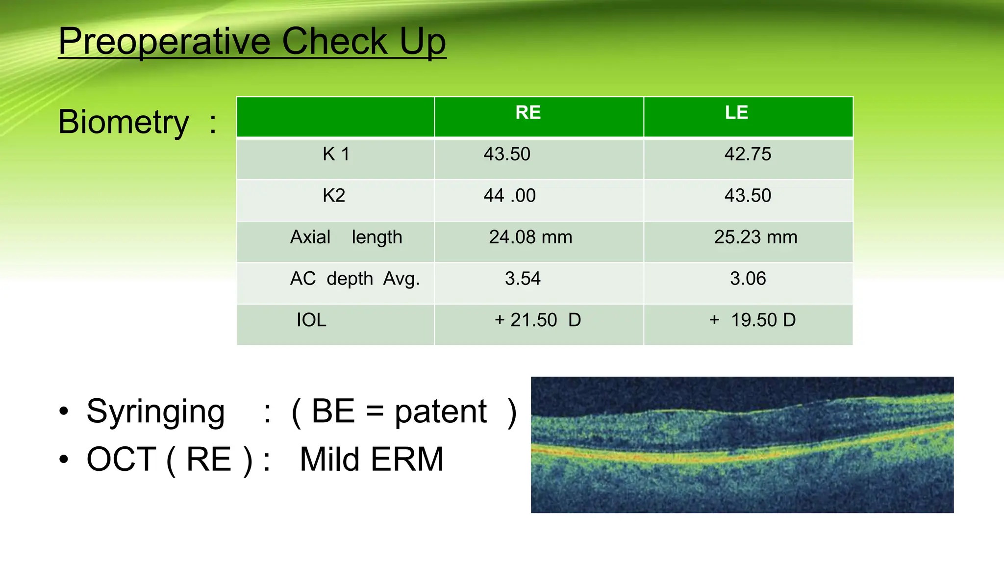 Cataract with clinical Case Presentation | PPTX
