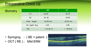 Cataract with clinical Case Presentation | PPTX