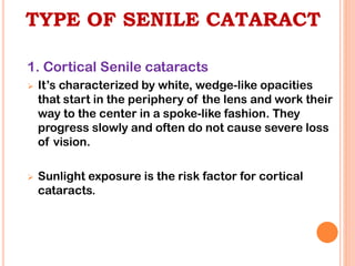 CATARACT RESEARCH WORK AND SEMINAR PRESENTATION | PDF