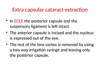 Cataract.ppt by sir azmat jehan for optometrists | PPT