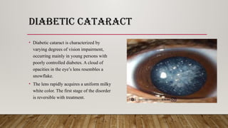 Anatomy of human eye ,cataract and its treatment | PPTX