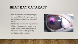 Anatomy of human eye ,cataract and its treatment | PPT