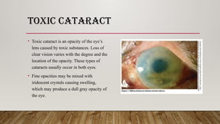 Anatomy of human eye ,cataract and its treatment | PPTX
