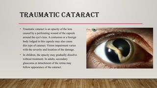 Anatomy of human eye ,cataract and its treatment | PPT