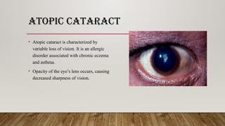 Anatomy of human eye ,cataract and its treatment | PPTX