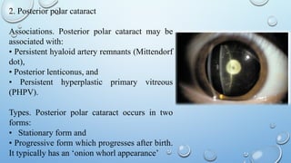 Cataract and its classification/types .pptx