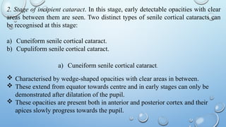 Cataract and its classification/types .pptx
