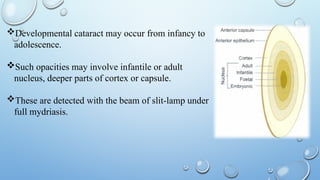 Cataract and its classification/types .pptx