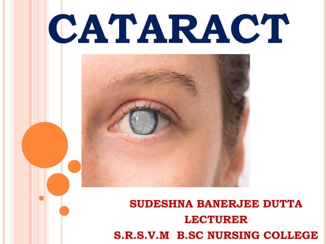 Cataract | PDF