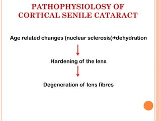 Cataract | PDF
