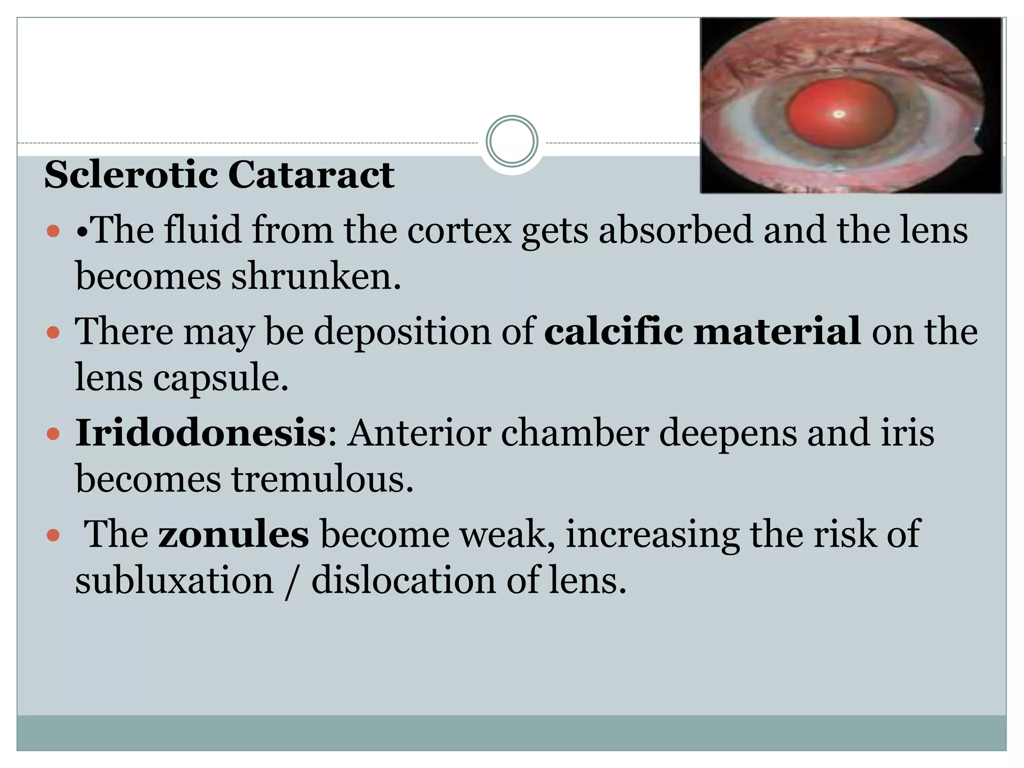 Cataract-Ppt.pptx