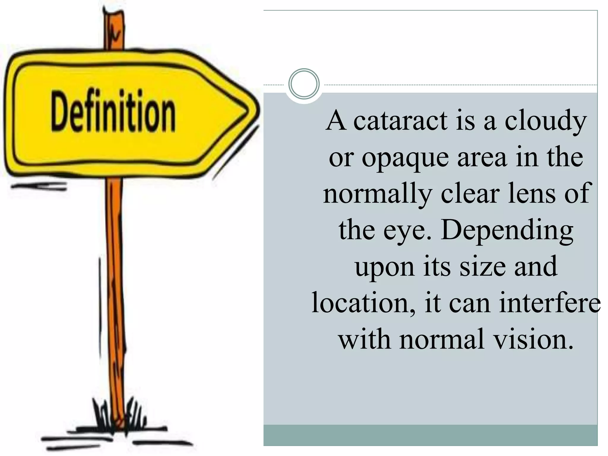 Cataract-Ppt.pptx | Eye and Vision Conditions | Diseases and Conditions