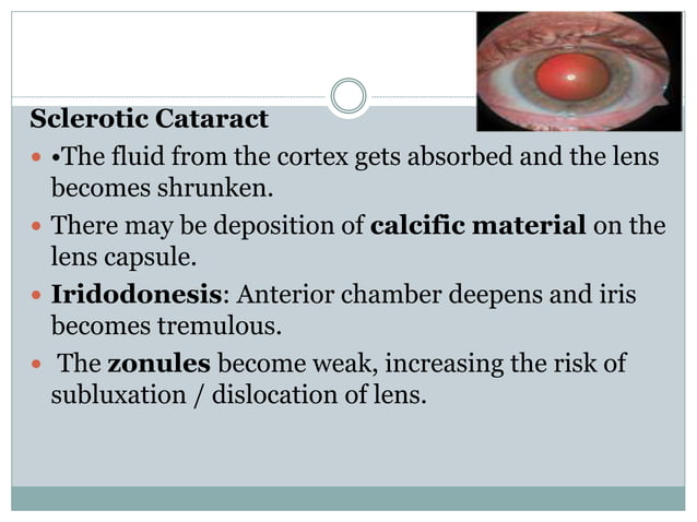 Cataract-Ppt.pptx | Eye and Vision Conditions | Diseases and Conditions