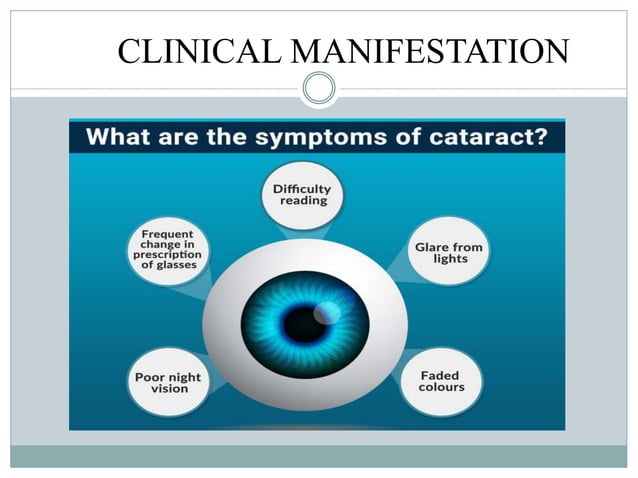 Cataract-Ppt.pptx | Eye and Vision Conditions | Diseases and Conditions