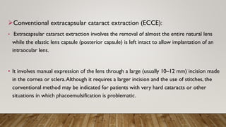 CATARACT-SURGERY.pdf | Eye and Vision Conditions | Diseases and Conditions