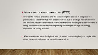 CATARACT-SURGERY.pdf | Eye and Vision Conditions | Diseases and Conditions