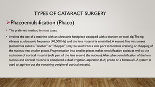 CATARACT-SURGERY.pdf