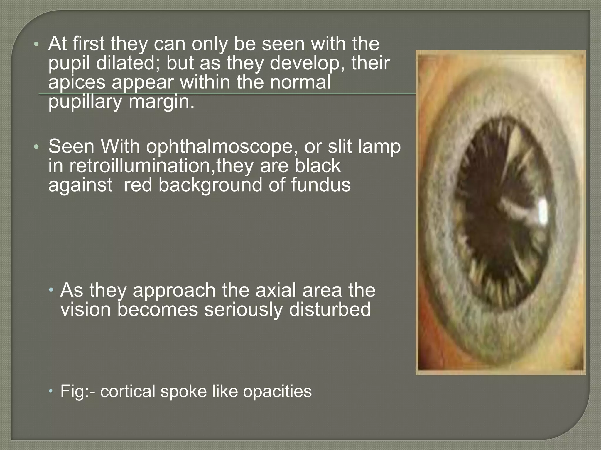 CATARACT 1.pptx