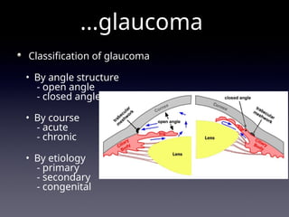 Cataract and Glaucoma disease of the eyeppt | PPT