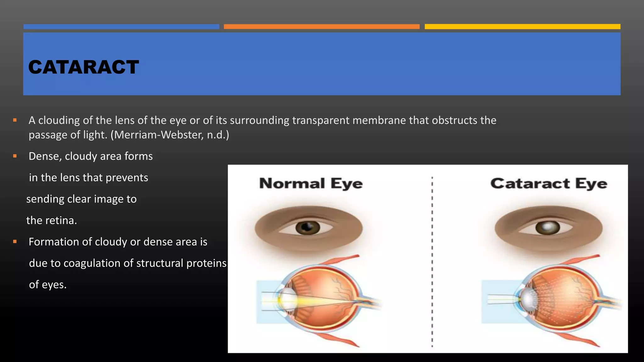 Cataract by Group 3.pptx