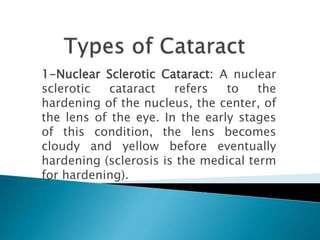 Cataract by Grp 5.ppt .. | PPTX