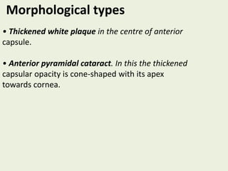 Congenital Cataract quick revision ( ophthalmology ) | PPTX