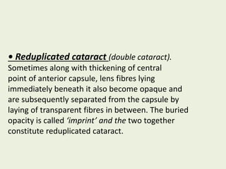 Congenital Cataract quick revision ( ophthalmology ) | PPTX