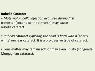 Rubella Cataract