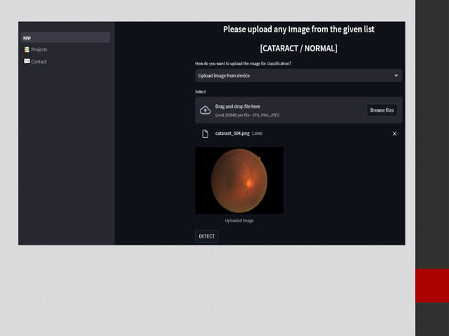 Eye Abnormality Detection Using Machine Learning Pptx Eye And Vision Conditions Diseases