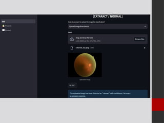 eye abnormality detection using machine learning | PPTX | Eye and ...