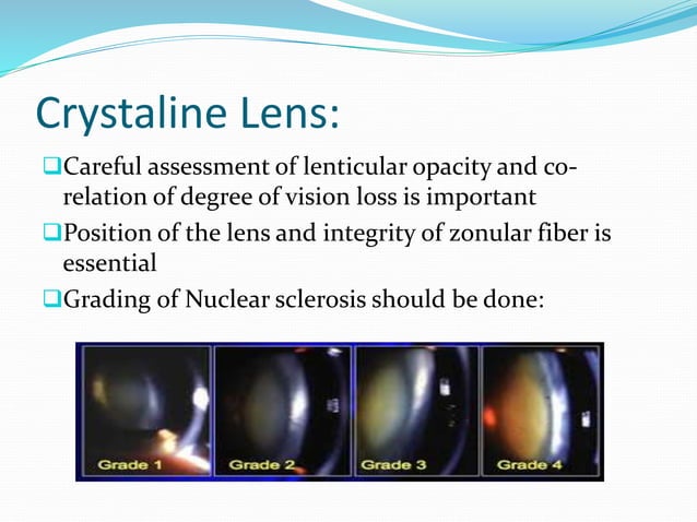 PRE-OPERATIVE EVALUATION IN CATARACT SURGERY | PPT | Free Download